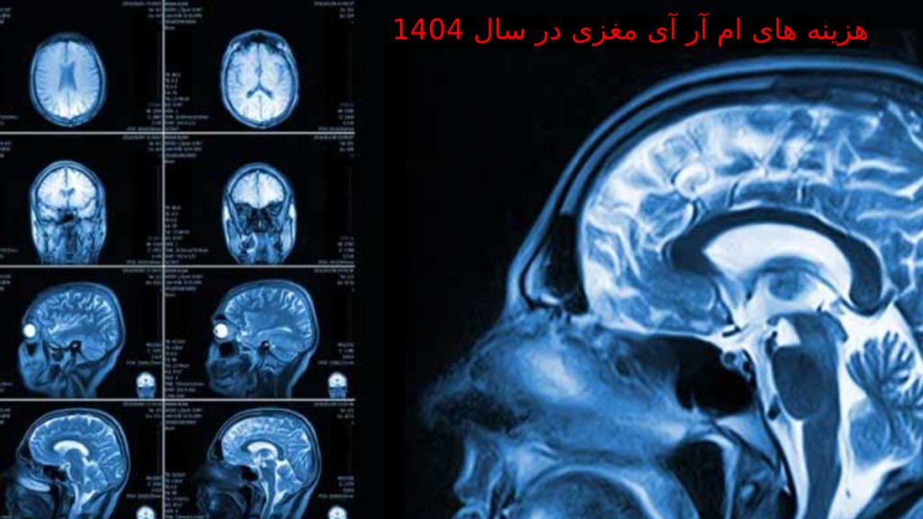 هزینه ام آر آی سال 1404 + قیمت MRI آزاد و با بیمه